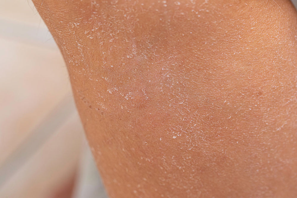 How to Get Rid of Dead Skin Cells from Your Face and Body | Black Wolf